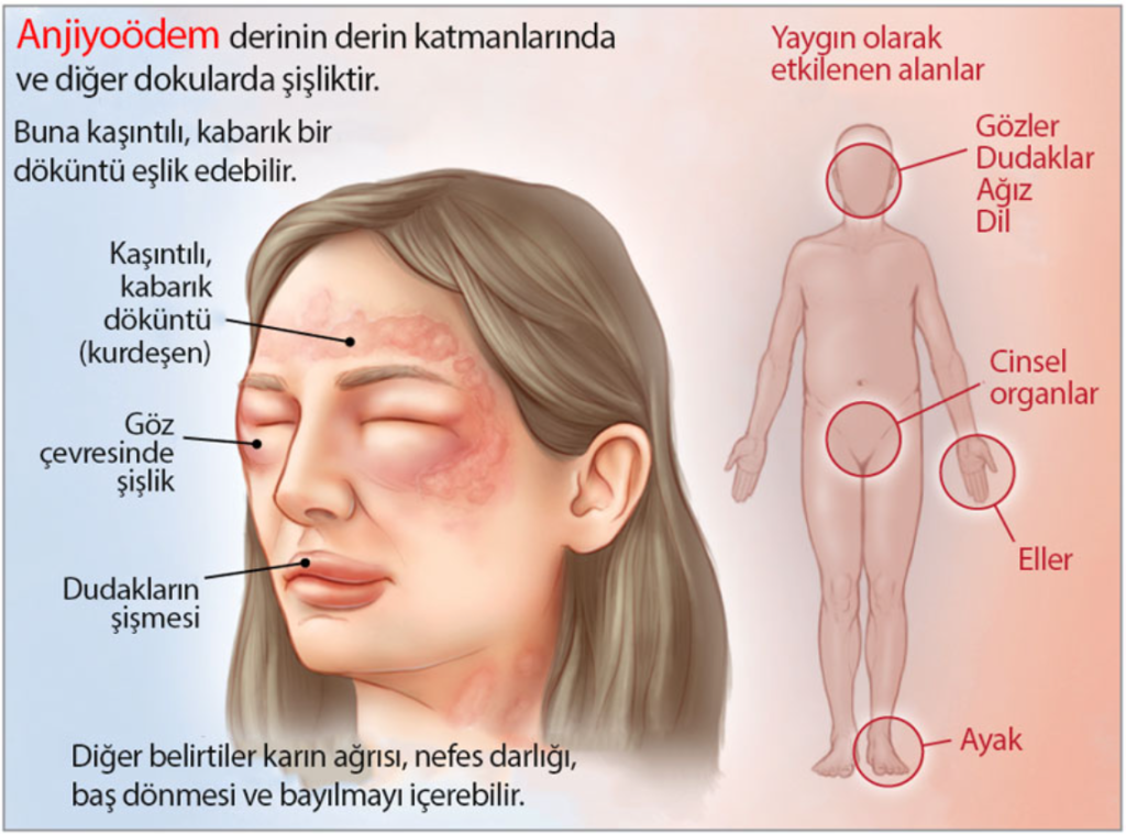 Haei hastalığı nedir? - Doktornumarasi.com